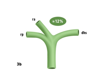 Anatomy - Cholecystectomy, laparoscopic