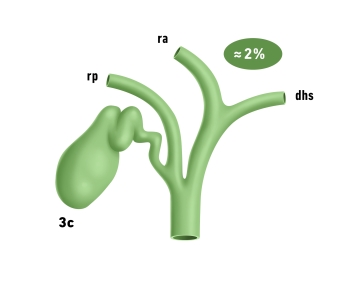 Anatomy - Cholecystectomy, laparoscopic