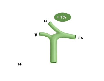 Anatomy - Cholecystectomy, laparoscopic