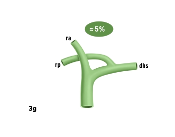 Anatomy - Cholecystectomy, laparoscopic