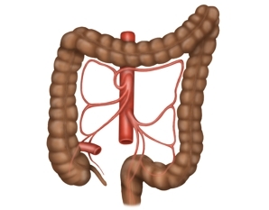 Anatomy - Laparoscopic colectomy with ileorectostomy